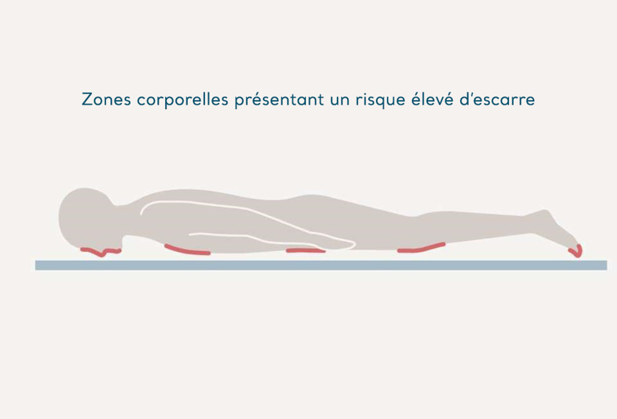 Escarres, Covid-19: positionnement en décubitus ventral | Arjo blog | Arjo